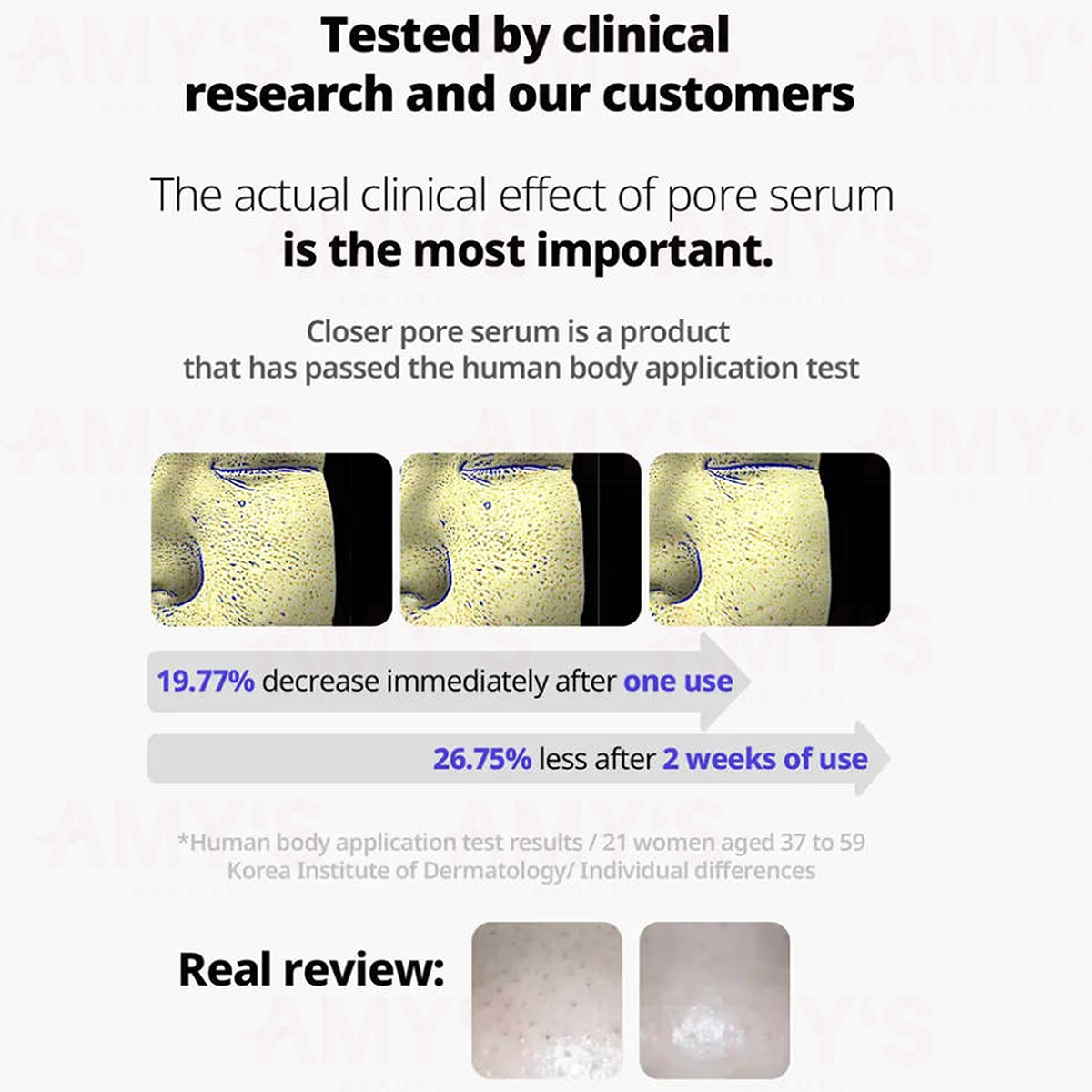 FRANKLY Closer Serum 30ml | Viral PDRN & PHA Pore Minimizer | 9 Peptide ...