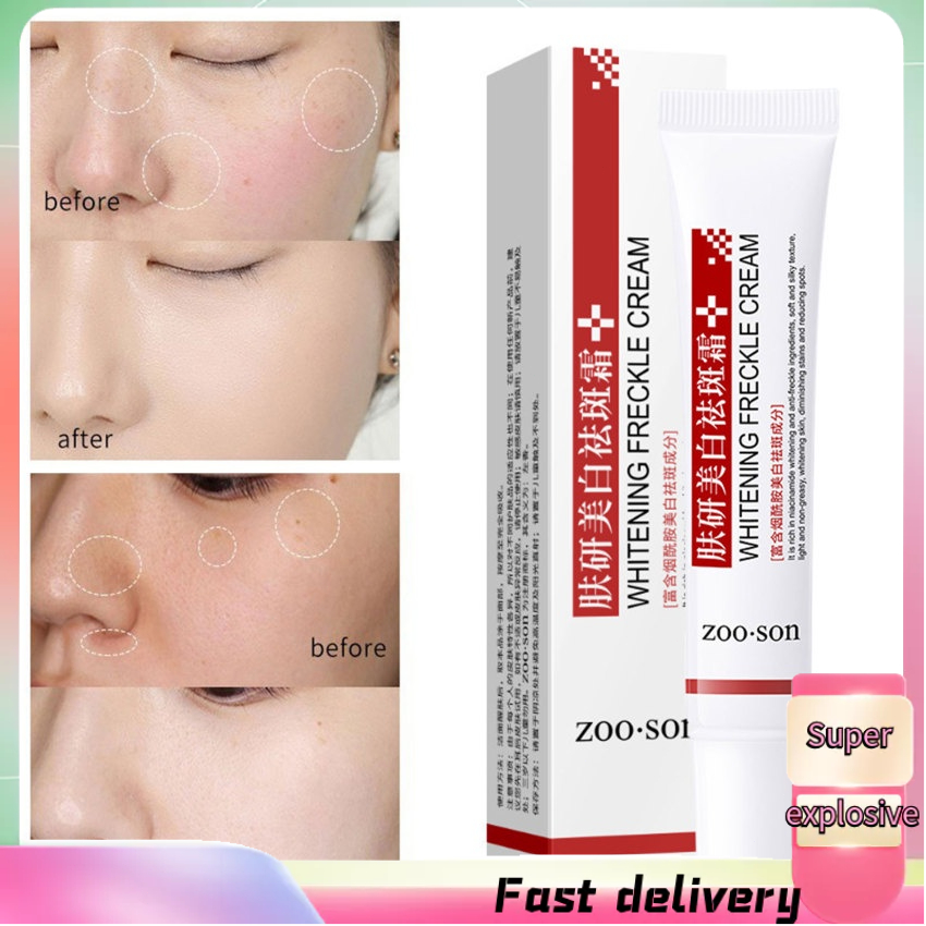 Dark Spot Corrector Cream Whitening Freckle Cream Powerful Removing Melasma Melanin Dark Spots ...