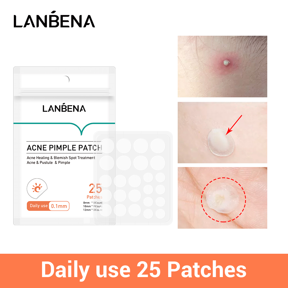 Tea Tree Stickers Daily Use Acne Stickers 0.1mm Isolate Dust Absorption ...