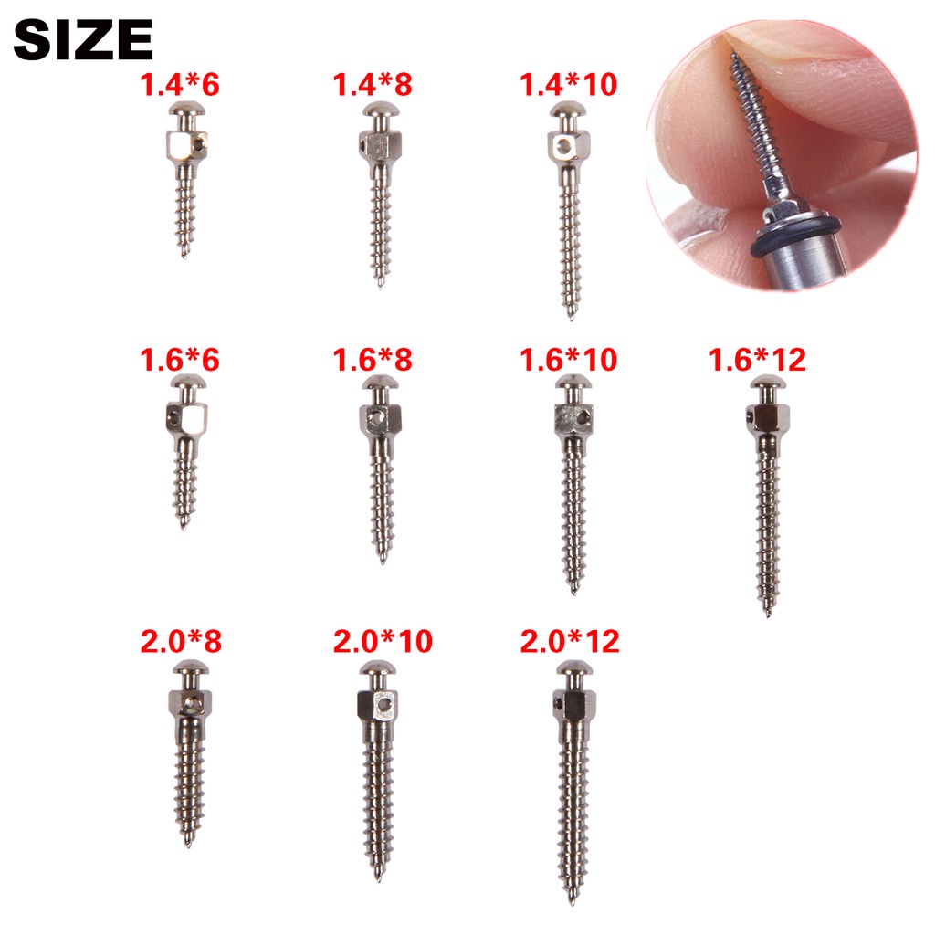 Mini Orthodontic Screws Micro Dental Implants | Shopee Malaysia