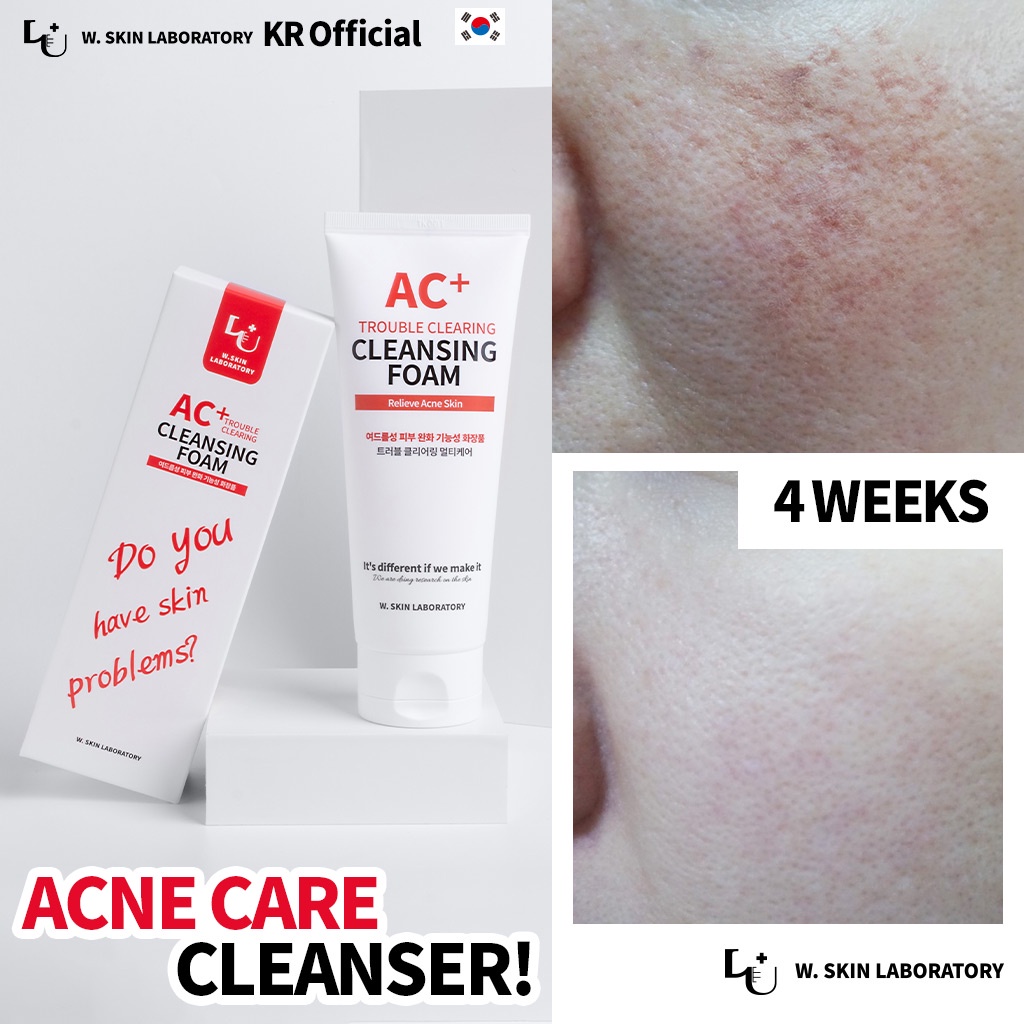 [W SKIN LABORATORY] AC+(Acne Care) Clearing Cleansing Form | Shopee ...
