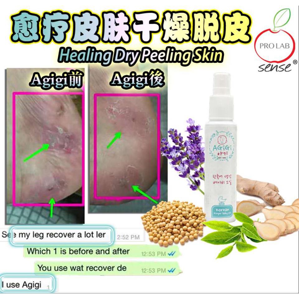 AGIGI Mist 100ML 改善皮肤干燥/干裂，淡化疤痕 Improves Dry Skin, Lighten Scars (Formulated From Korea ...