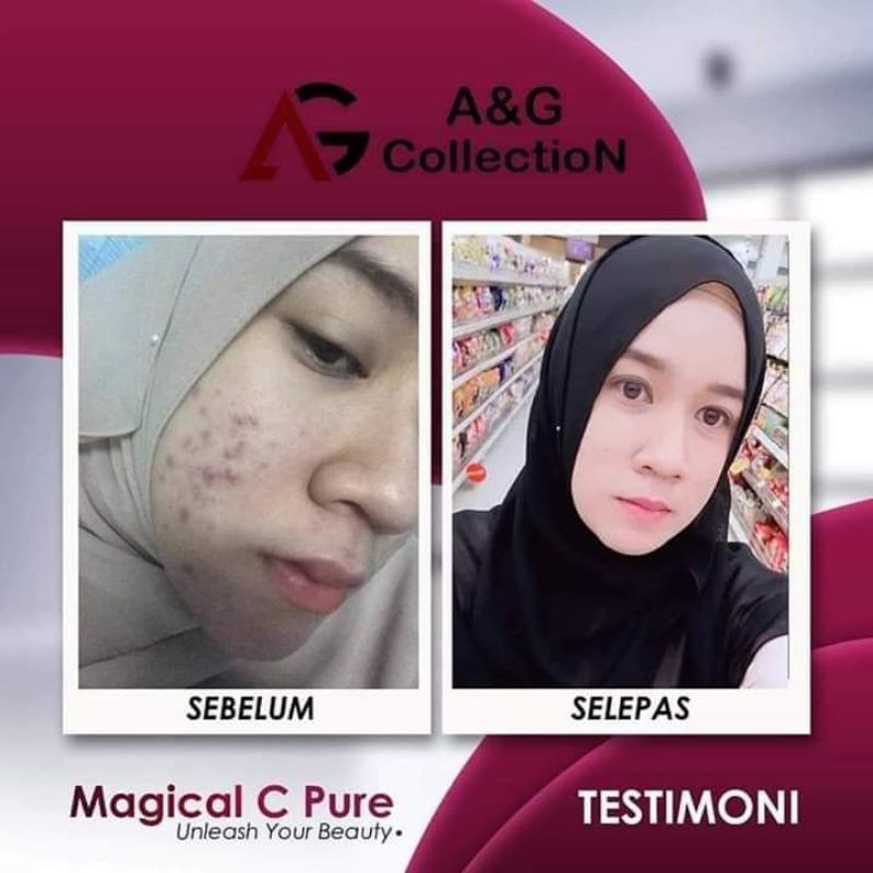 💯Original (Ready Stok)Magical C pure [kemam,putih,berseri] | Shopee ...