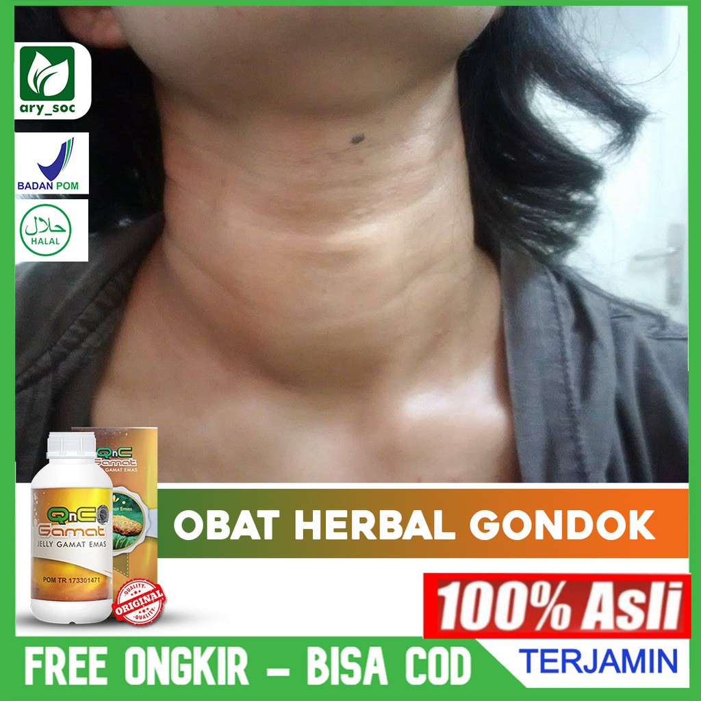 Mumps Medicine - Toxic Mumps - Abnormal Lumps in the Neck Most - Lipoma ...