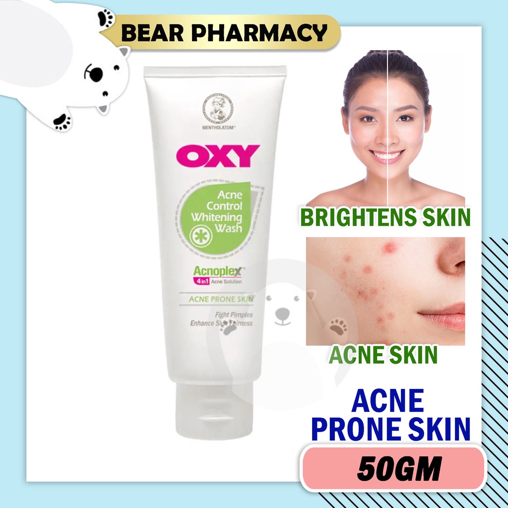 OXY Acne Control Whitening Wash 50g [Exp: 07/2025] Face Wash, Pimples ...