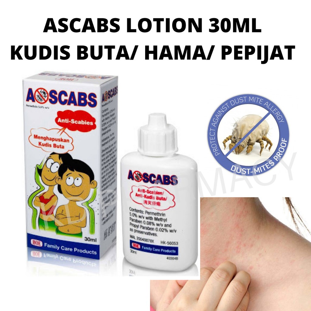 [STOCK CLEARANCE]!!!HOE A-SCABS ANTI SCABIES/MENGHAPUS KUDIS BUTA 30ML ...