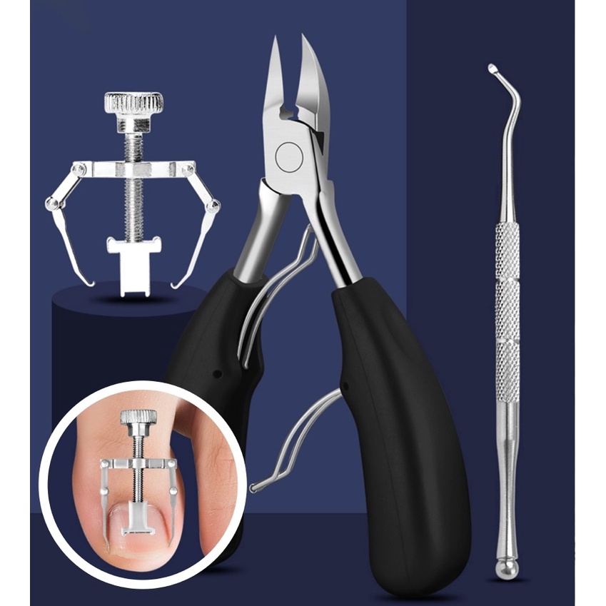 3pc/Set Corrector Clipper Lifter Kit Nail Nipper Fixer Pedicure Recover ...