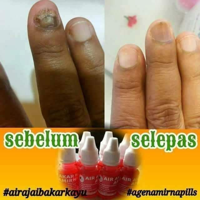 Air akar kayu amirna (amirna multi purpose water) | Shopee Malaysia