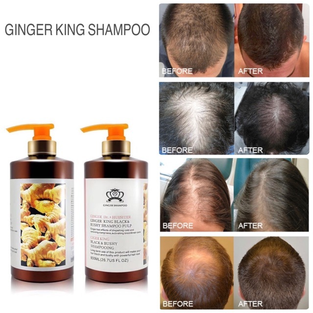 Ginger Shampoo Genuine Extract Natural Laoshan Ginger Anti-dandruff ...