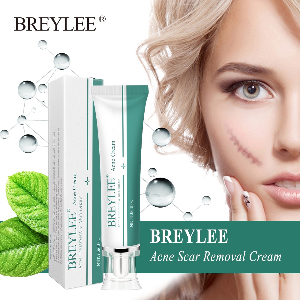 BREYLEE Scar Removal Treatment Cream Acne Treatment Cream Acne Scars Treatment Gel 30g | Shopee ...