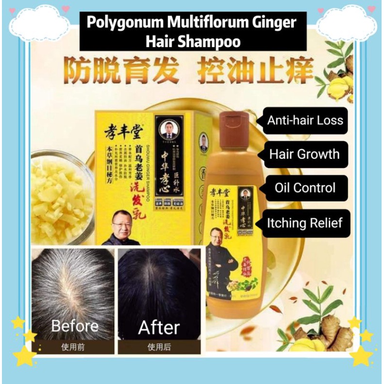 Polygonum Multiflorum Ginger Hair Shampoo (260ml) Anti-hair Loss Relief ...