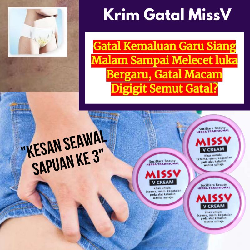 BERKESAN ‼️ Gatal Kemaluan Eczema Cream Krim Gatal Kulit | Krim MissV ...