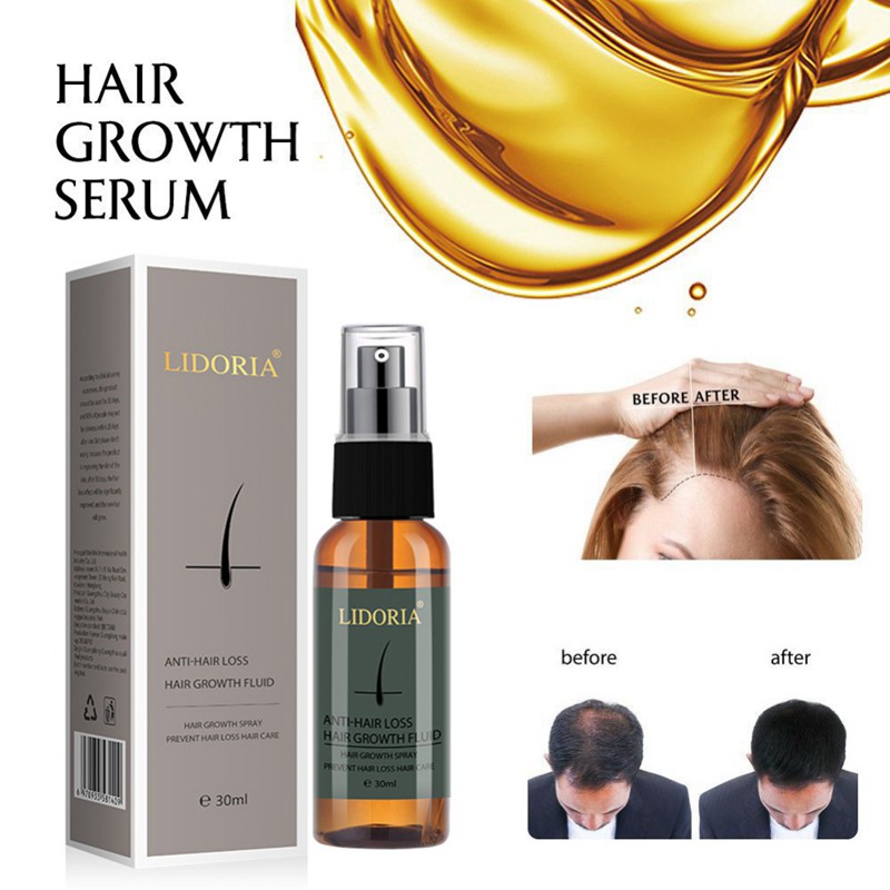 Lidoria 30ml Hair Growth Essential Oil Essence Anti Hair Loss Liquid