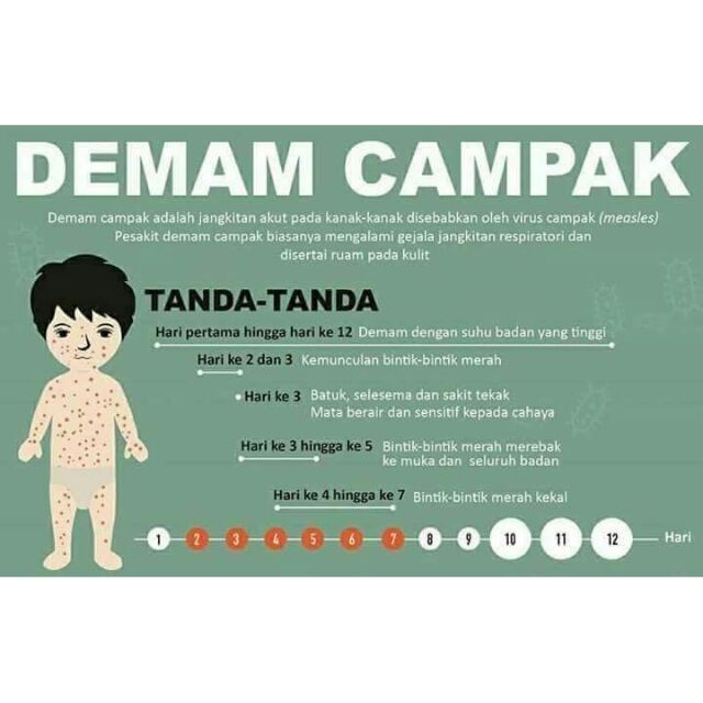 Set Rawatan Demam Campak | Shopee Malaysia
