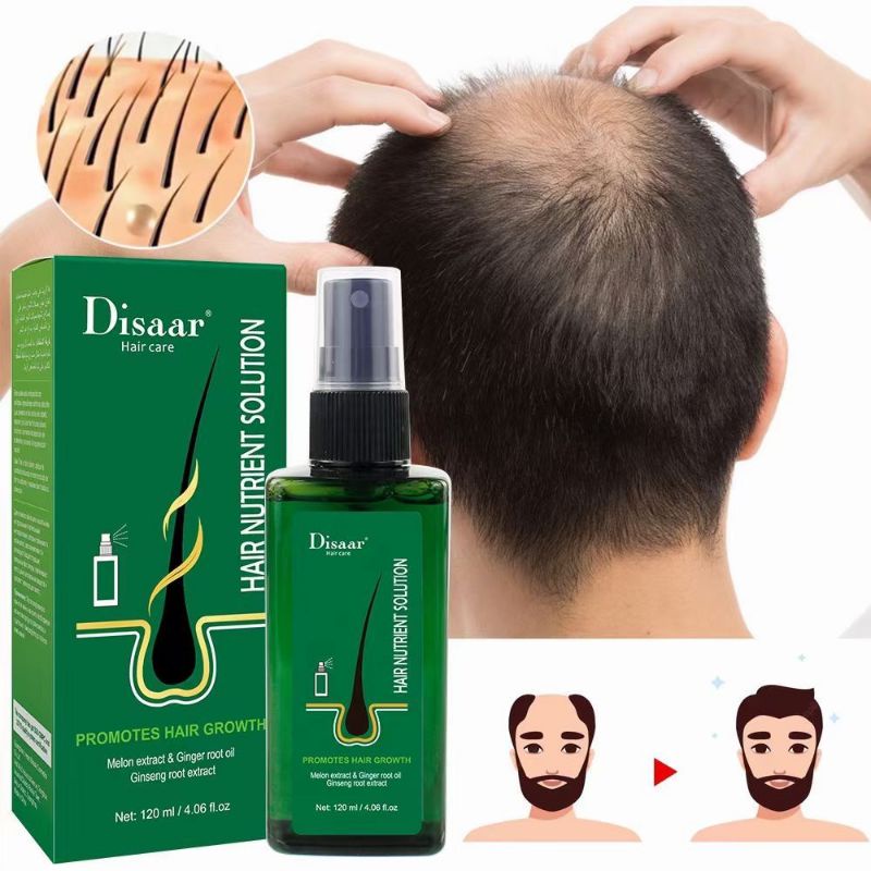 Dissar Hair Nutrient Solution Promotes Hair Growth Save Hair Loss Hair ...