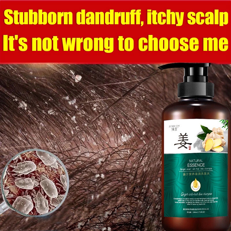 Shampoo Anti Dandruff Refreshing Oil Control Hilangkan Kelemumur Ubat