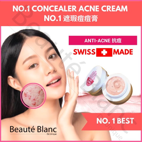 🔥Ready Stock🔥🇨🇭 | Swiss Made Pimple Cream | Ubat Jerawat Concealer Muka ...