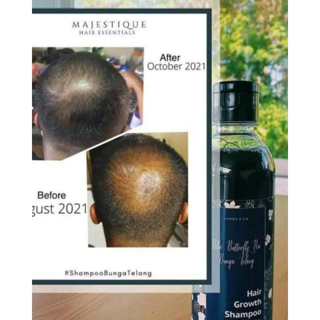 shampoo bunga telang 330ml | Shopee Malaysia