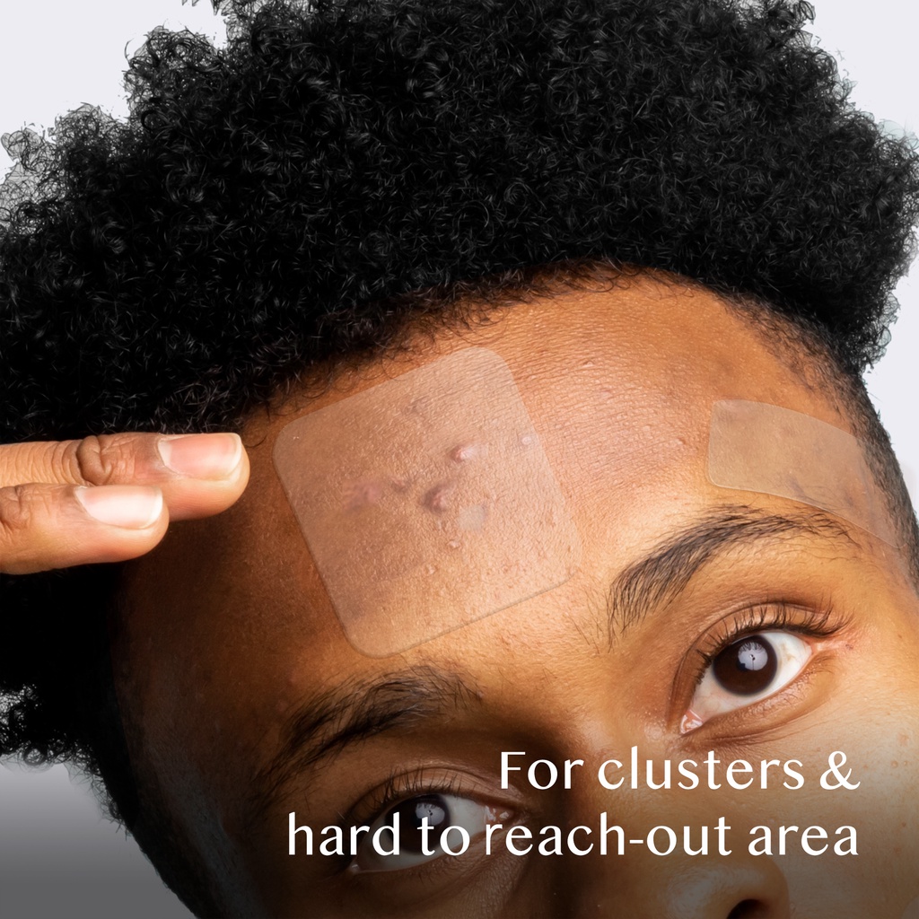 AVARELLE Pimple Cover Patch (50mm) Big Acne Hydrocolloid Patch with ...