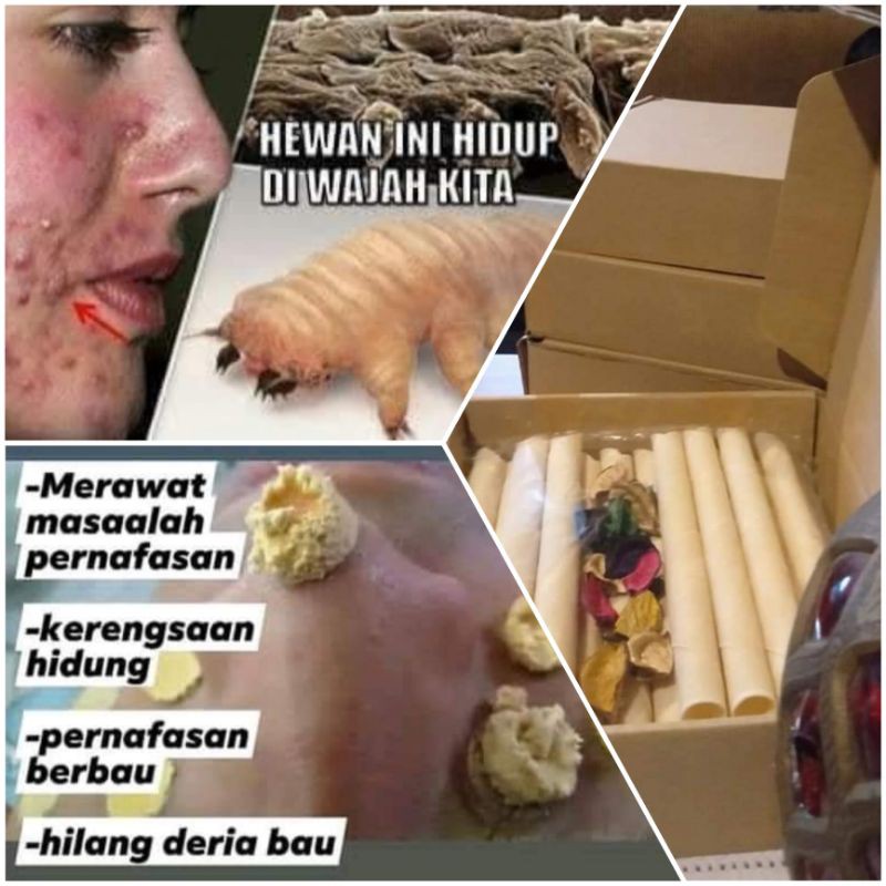 Corong herba Resdung (10 Batang) | Shopee Malaysia