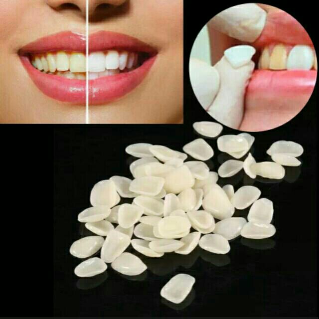 teeth covering resin teeth, instant teeth cover With Dental Glue ...