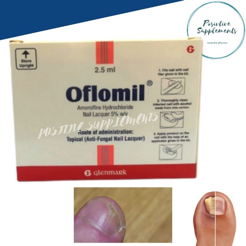 OFLOMIL NAIL FUNGAL TREATMENT 2.5ML SET | Shopee Malaysia