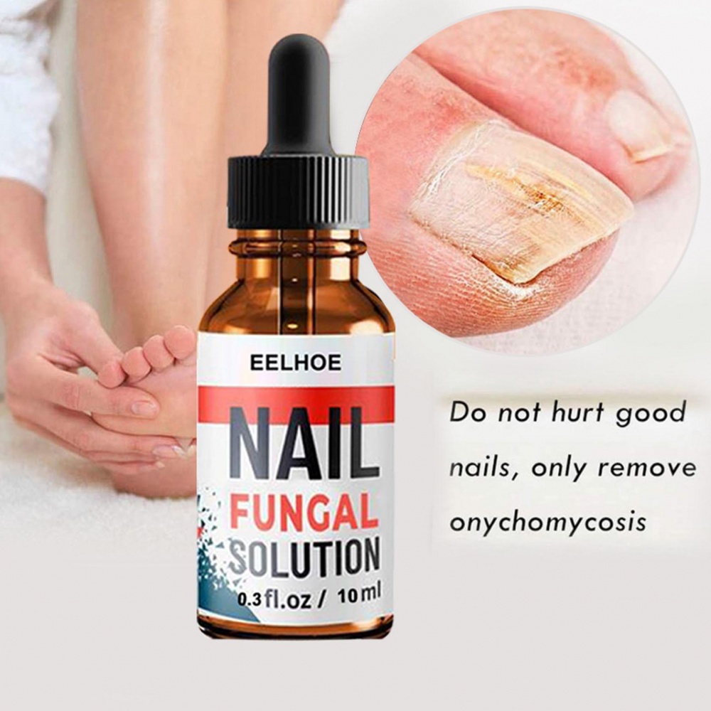 30ML Nail Repair Solution Against Discolored & Damaged Nails Fungal ...