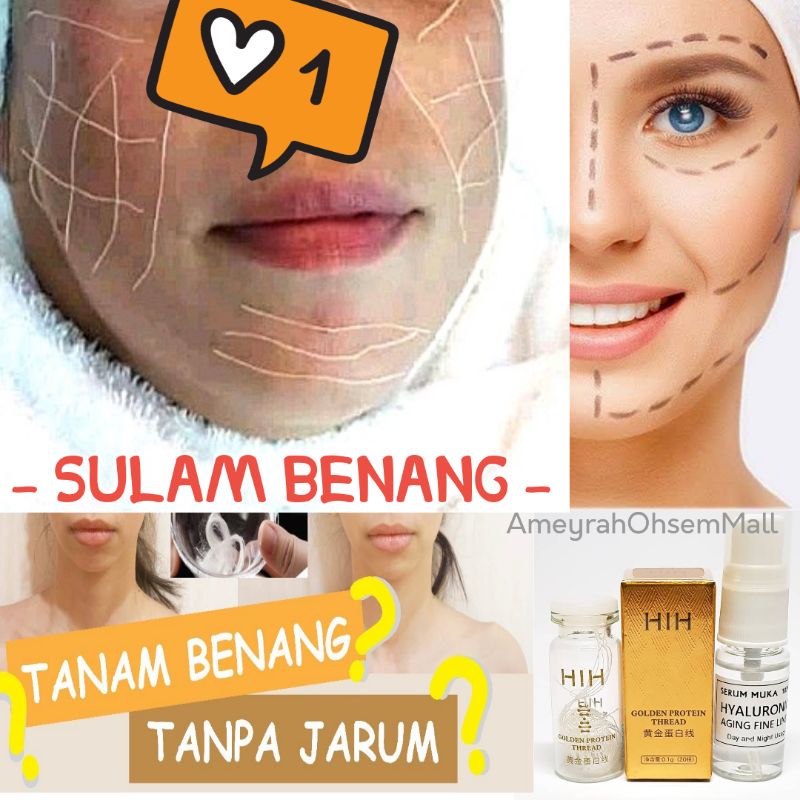 Sulam Benang Muka/ Tanam Benang Tanpa Suntik/ Face Lifted/ Fight ...