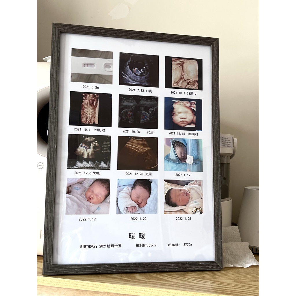 🔥 MY LOCAL MADE🔥 Baby Ultrasound Scan Photo Frame Deco｜Personalized ...