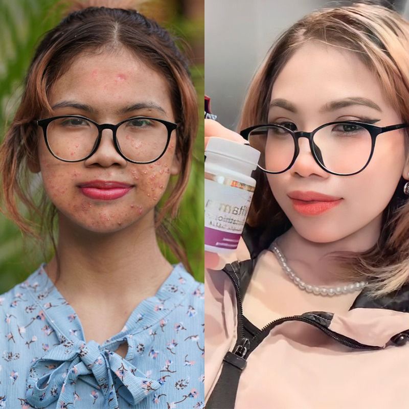 Vitamin C Glutathione Plus Sufee Snow ( VCGP ) | Shopee Malaysia