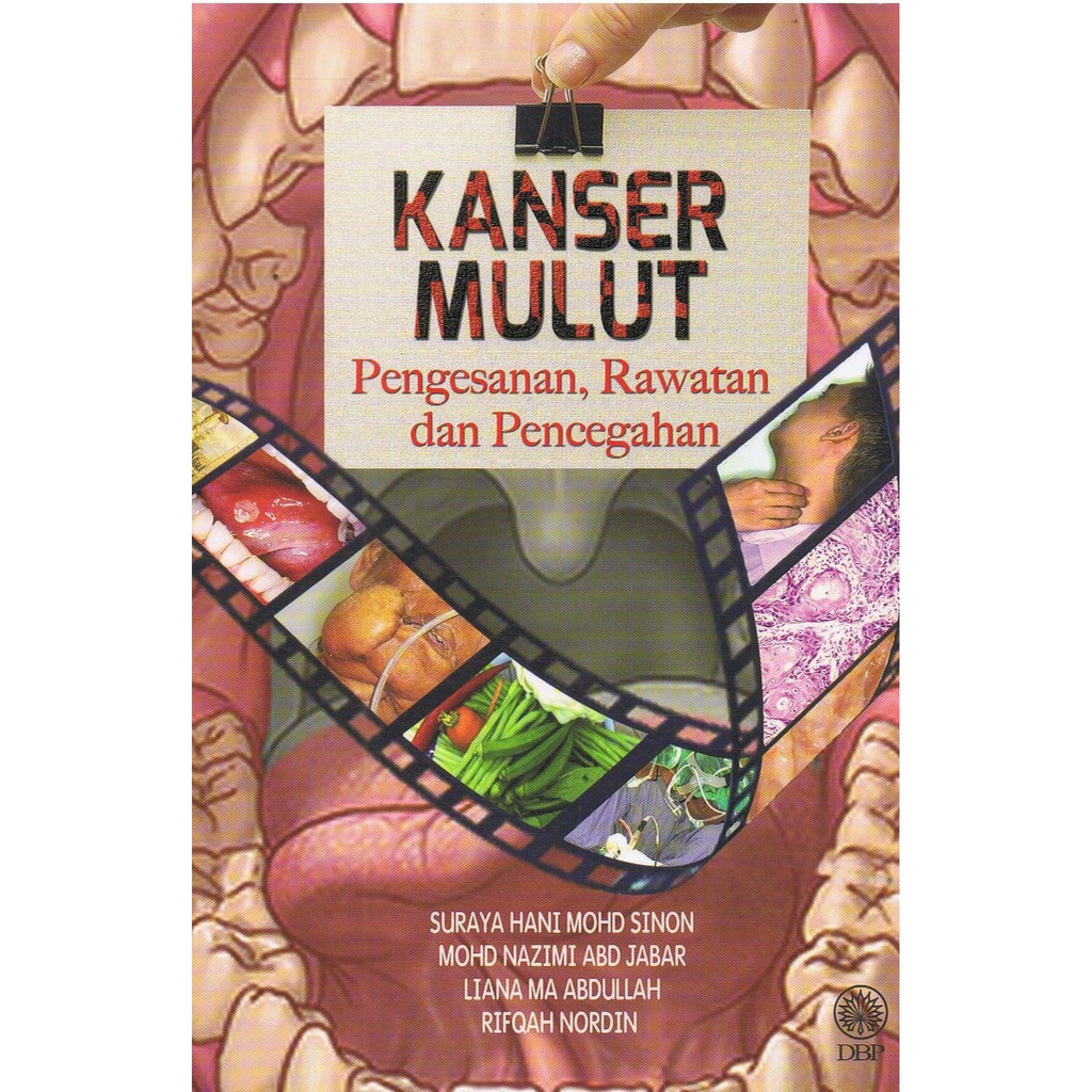 DBP: Kanser Mulut Pengesanan, Rawatan Dan Pencegahan | Shopee Malaysia
