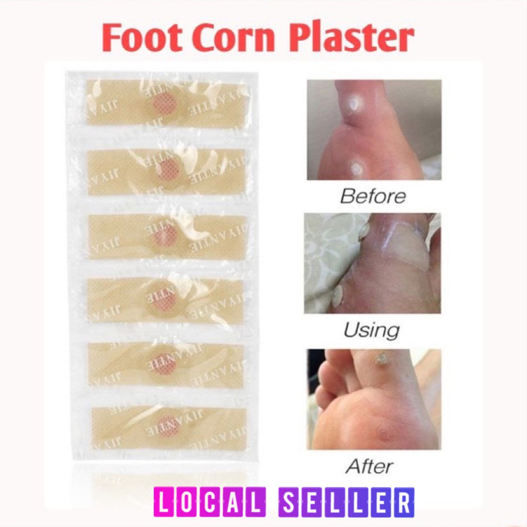 🔥Local Seller🇲🇾6pcs/12pcs Foot Corn Removal Plaster Warts Thorn Patch ...