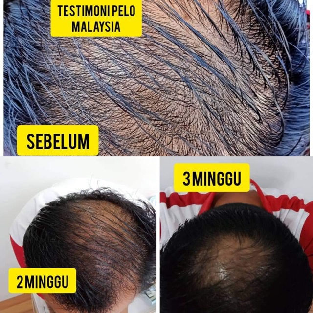 🔥 SUPER JIMAT🔥PELO - PELEBAT RAMBUT DAN JAMBANG 50G | Shopee Malaysia