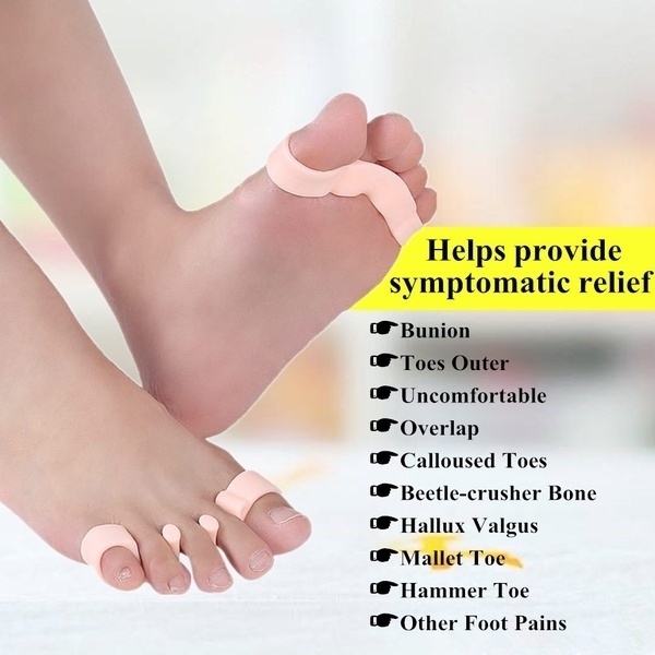 Multifunctional 5-hole hallux valgus orthosis, toe separation | Shopee ...