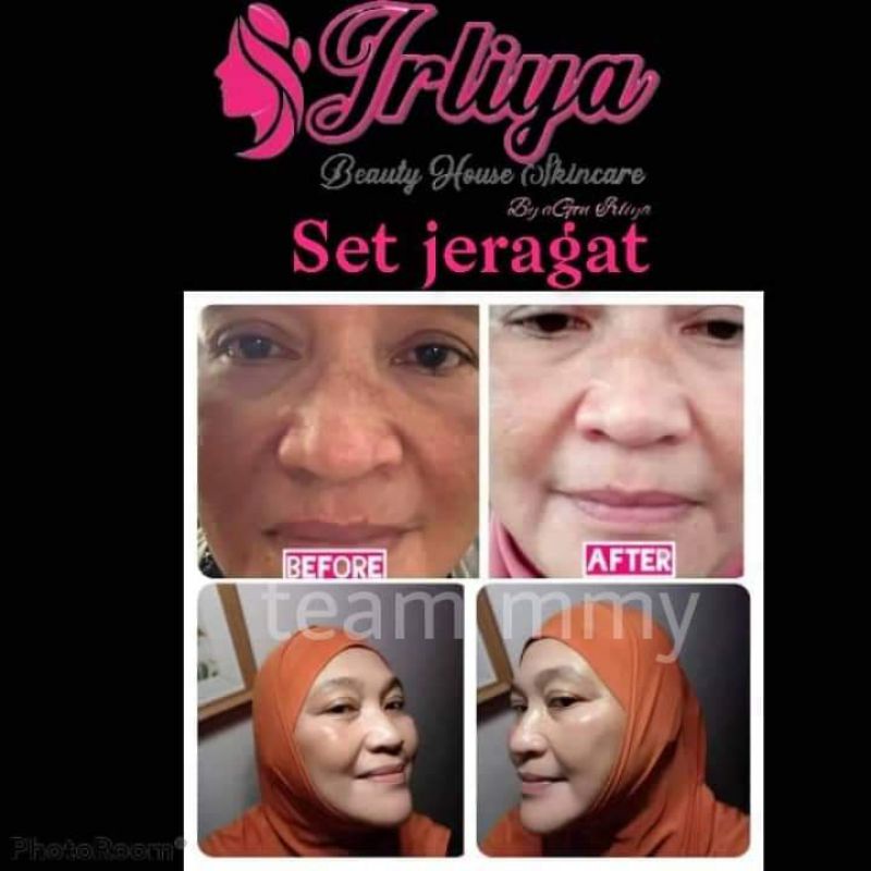 IRLIYA BEAUTY SKINCARE (SET JERAGAT) | Shopee Malaysia