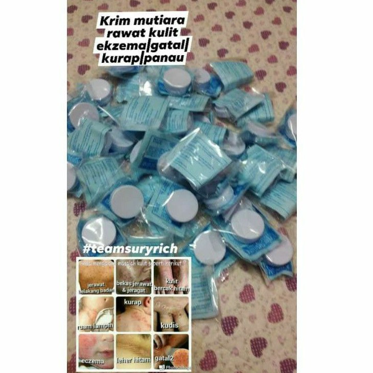 KRIM MUTIARA ASLI RAWAT KUDIS | ECZEMA | KURAP | PANAU | RUAM |KULAT ...