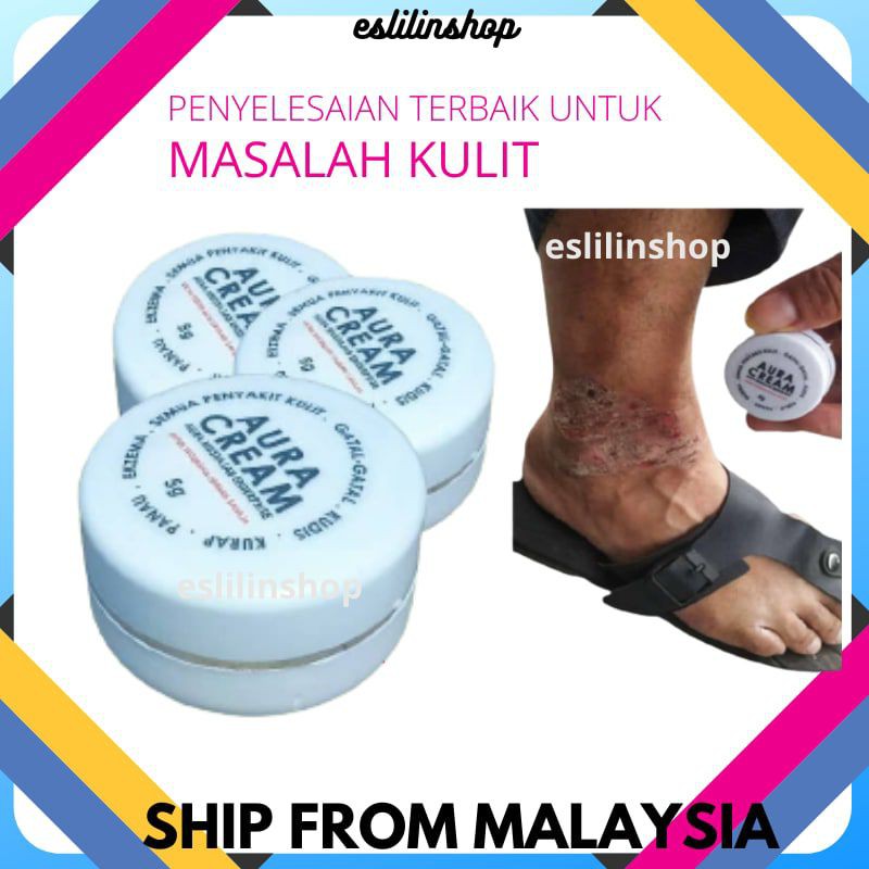 Ubat Gatal Kulit Krim Herba Cina Panau Paling Berkesan Aura Cream ...