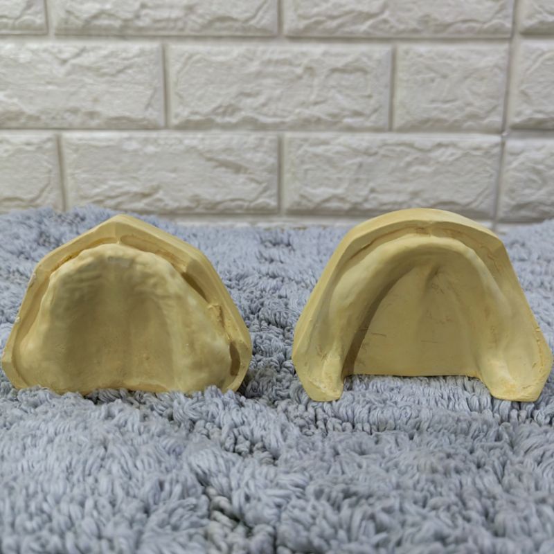 CD Patient's Cast (Edentulous Cast from Patient) | Shopee Malaysia