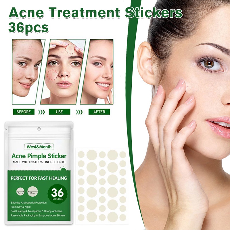 Acne Pimple Patch Hydrocolloid Acne Spot Treatment Invisible Pimple ...