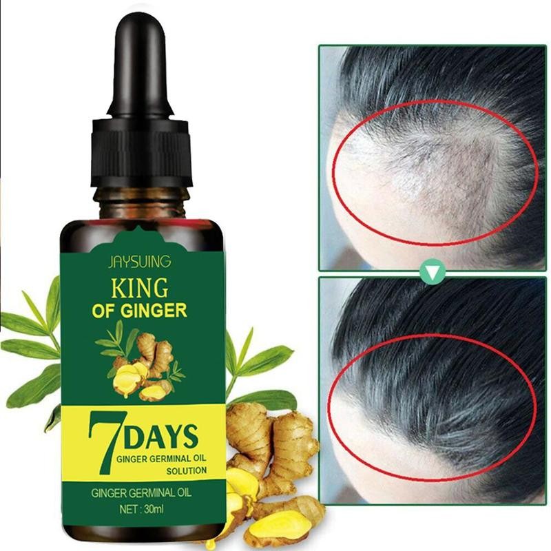 30ml Ginger King Hair Nutrient Solution Natural And Fast Treatment Of