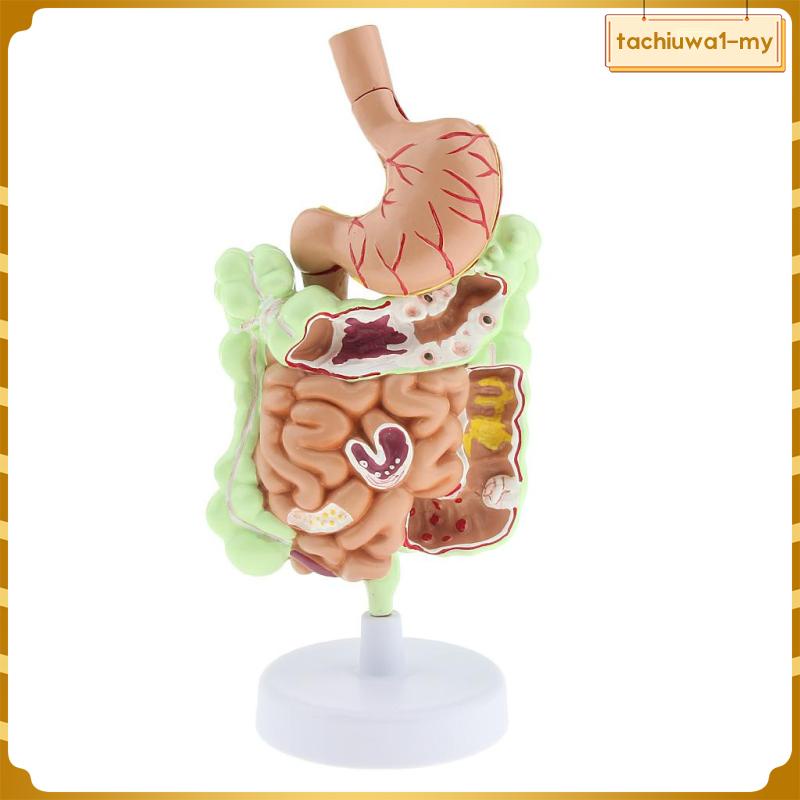 [tachiuwadcMY] of Human Digestive System Stomach Gastrointestinal Model ...