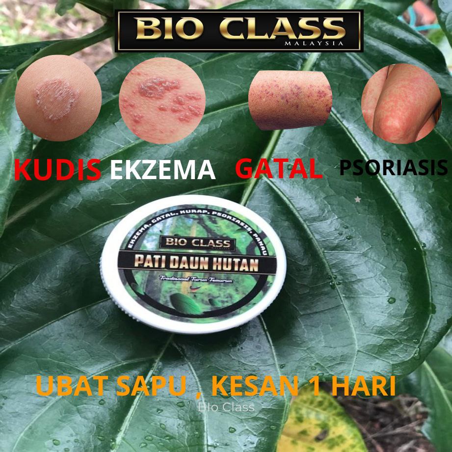 Ubat Gatal Psoriasis Cream Kurap Dan Gatal Krim Pati Hutan Acne Cream ...