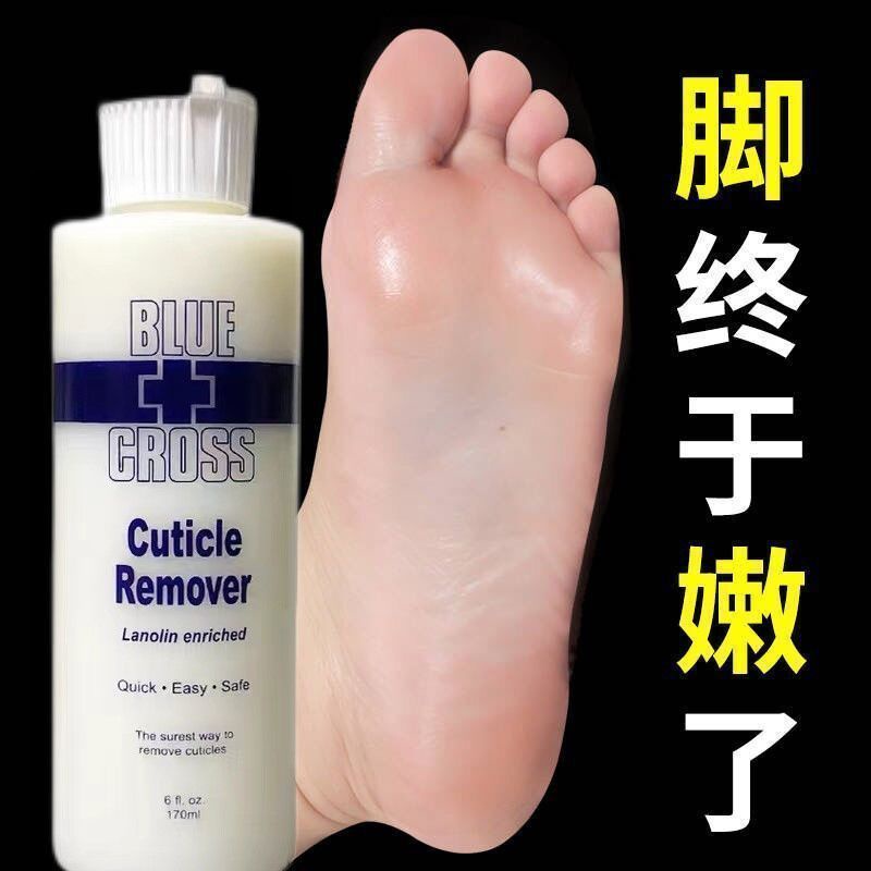 15 seconds heel exfoliation artifact sole cracking15秒脚后跟去死皮神器 脚底开裂厚老茧脱皮 ...