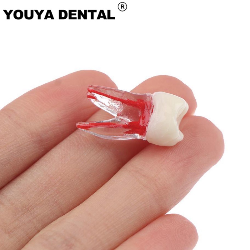 1Pcs Resin Dental Endodontic Tooth Model Colored Root Canal Pulp Model ...