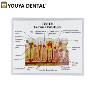 Suitable for School Dentistry Standard Oral Dental Anatomy Teaching ...