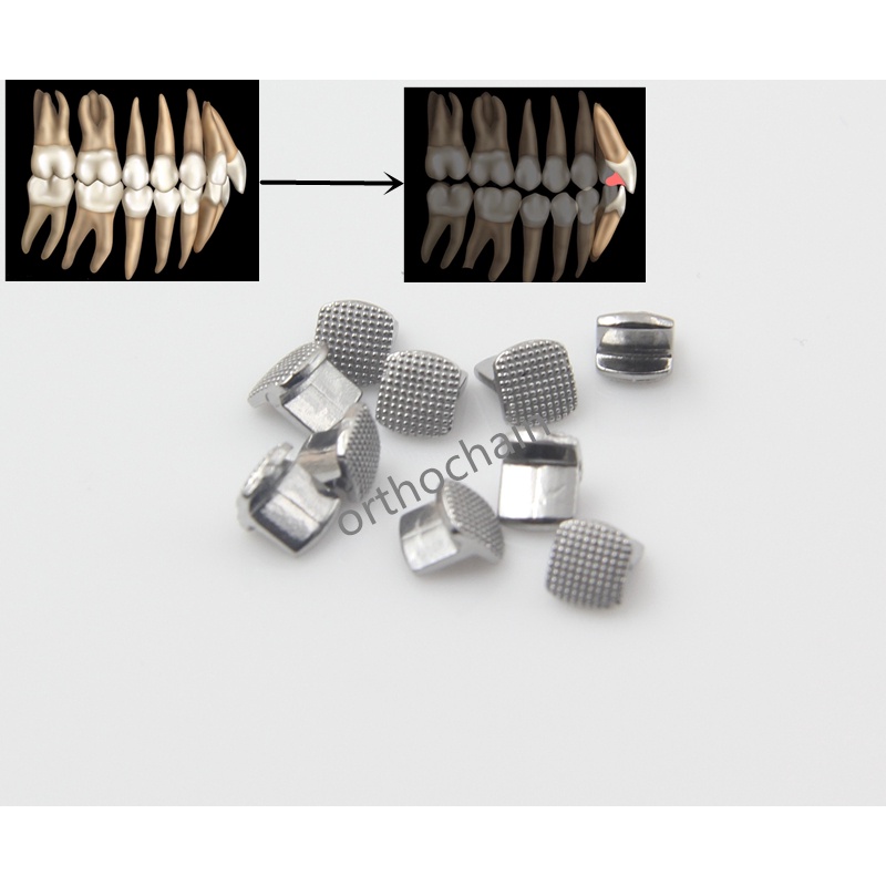 10pcs Dental Orthodontic Bite Builder Anterior Bite Turbos for deep ...