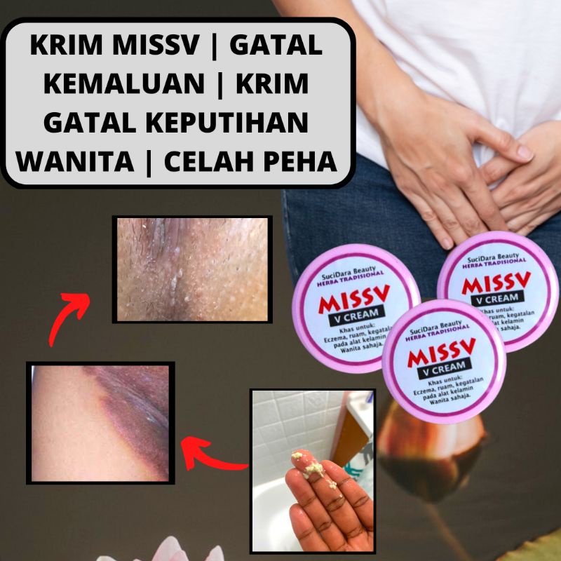 Limited🔥krim miss V Atasi GATAL Celah peha | Keputihan |GATAL kulit ...