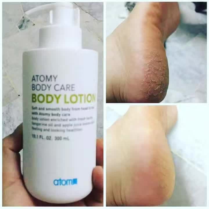 ATOMY BODY LOTION (300ml) 艾多美身体乳液 lotion badan natural lotion | Shopee ...