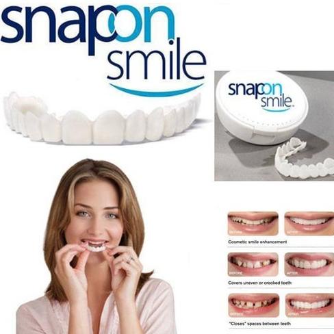 Snap On Smile 100% ORIGINAL Authentic / Snap'n Smile Dentures | Shopee ...