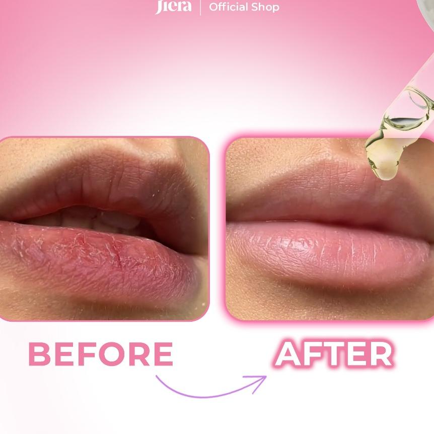 Jiera Natural Lip Serum 20Ml (Special Campaign) | Shopee Malaysia